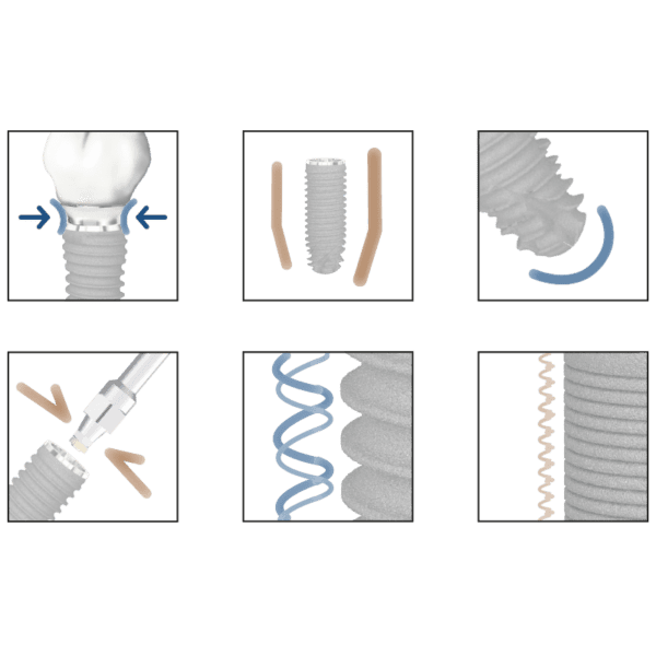 Bone Level Implant - TBR Dental